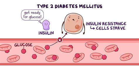 Antidiabetic Therapy Non Insulin Oral Antidiabetic Drugs Osmosis