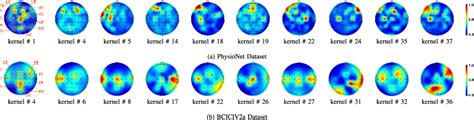 figure 2 from motor imagery classification via temporal attention cues of graph embedded eeg