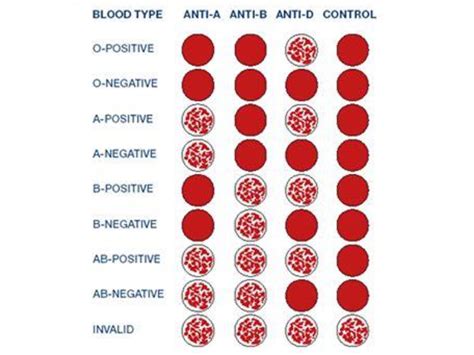 Determination Of Blood Group HAP Lab Manual PDF MCQ Video Synopsis
