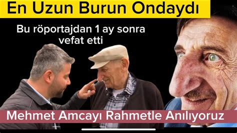 Dünyanın en uzun burunlu adamı Artvinli Mehmet Özyürekin son