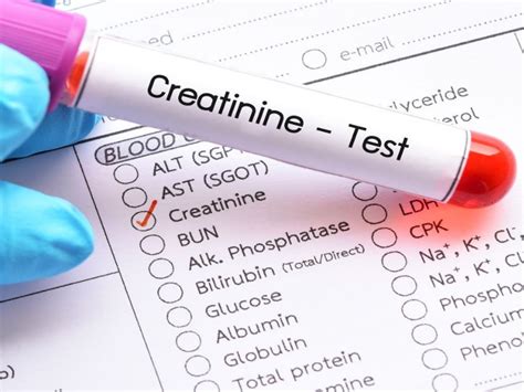 Créatinine faible dans le sang ou l urine symptômes causes et