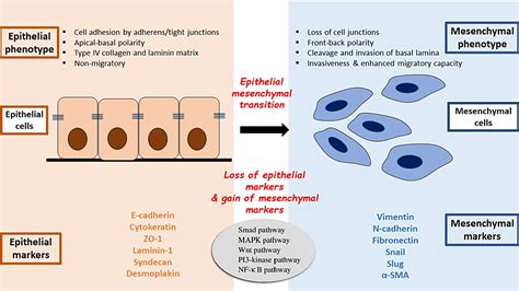 Is Epithelial Mesenchymal Transition A New Roadway In The Pathogenesis