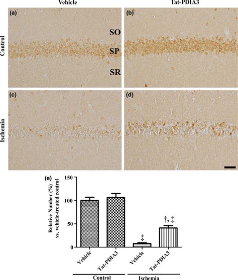 Microphotographs Of NeuN Immunohistochemical Staining In The DG Of