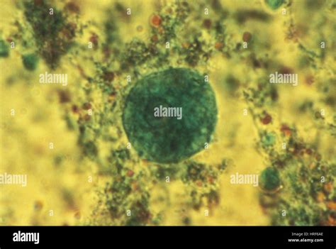 Entamoeba Coli Troph Hi Res Stock Photography And Images Alamy