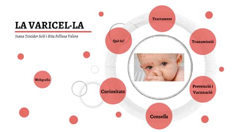 La Varicella By Rita Pellissa On Prezi