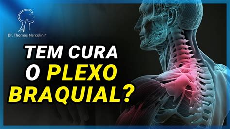 Ser Que A Les O De Plexo Braquial Tem Cura Conhe A Os Tratamentos