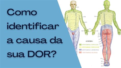 Mapa de dermátomo é fundamental para identificar a dor YouTube