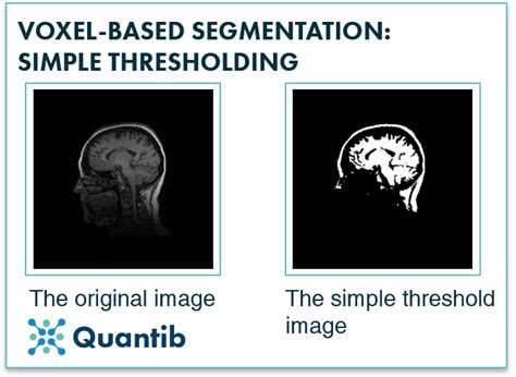 deep learning applications in radiology image segmentation
