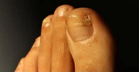 Reconstrucción de uñas Qué es EZpies