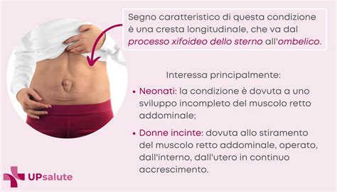 Diastasi Addominale UPsalute