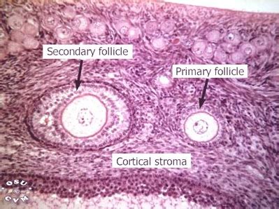 Ovary Slide Labeled Graafian Follicle