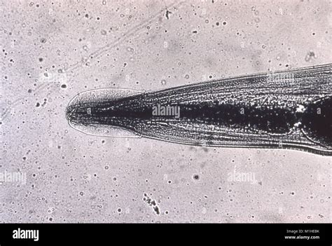 Enterobius Vermicularis Labeled