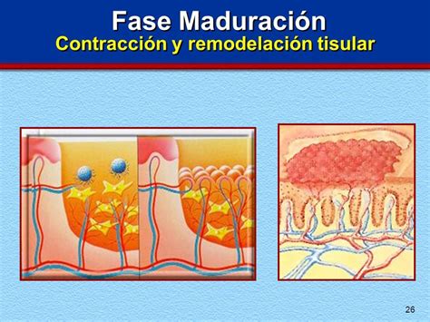 LAS HERIDAS FASES DE LA CICATRIZACIÓN