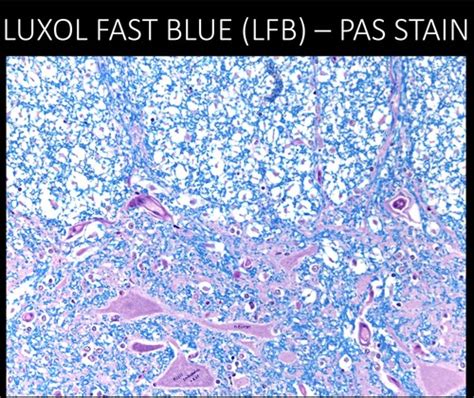 Special Stains Histology Flashcards Quizlet
