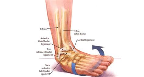 Anatomy Of An Ankle Sprain BoulderCentre For Orthopedics Spine