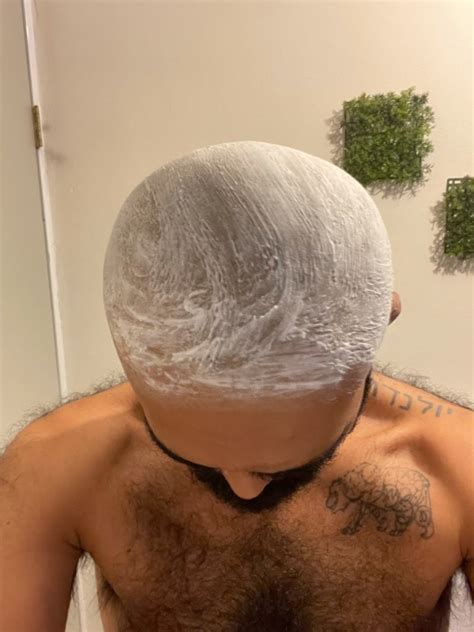 Bald On Tumblr