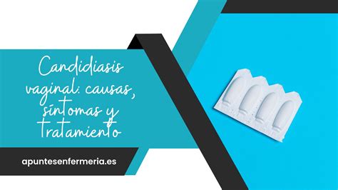 Candidiasis vaginal causas síntomas y tratamiento Apuntes enfermería