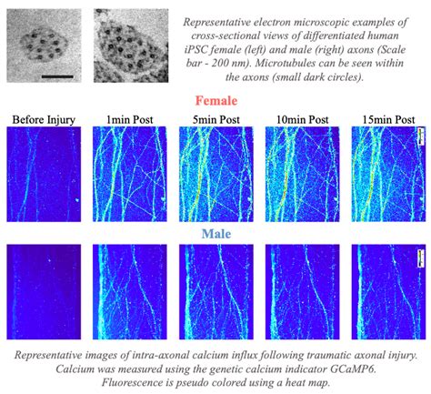 Diffuse Axonal Injury Histology