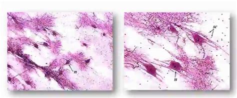 artificial neural network — part 1 laptrinhx
