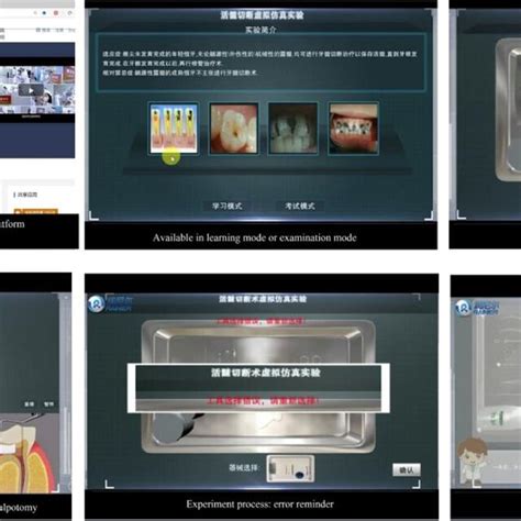 the virtual simulation experimental platform for teaching pulpotomy download scientific diagram