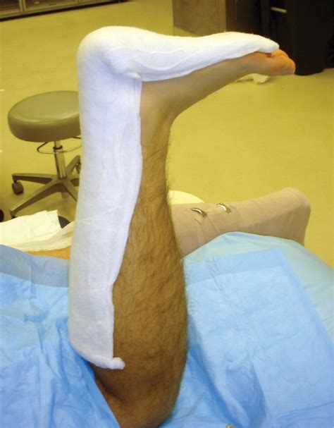 Diagnosis And Management Of Common Foot Fractures Aafp