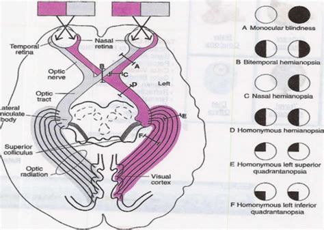 Neuro Review Final Flashcards Quizlet