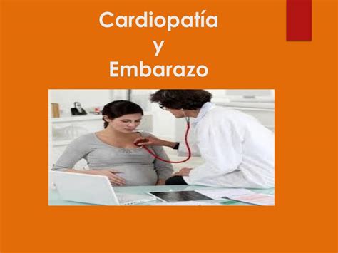 Cardiopatía Y embarazo MEDilove uDocz