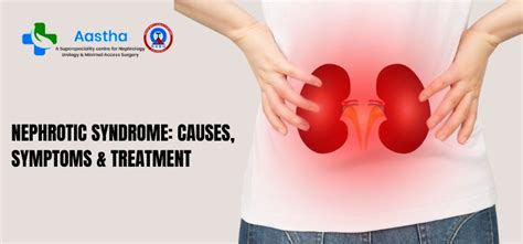 Nephrotic Syndrome Causes Symptoms Treatment