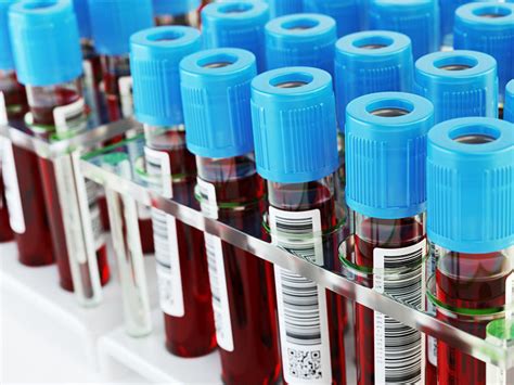 Cómo interpretar un análisis de sangre