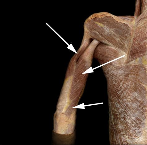 Posterior Upper Arm Muscles Diagram Quizlet