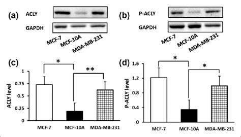 Western Blot Showing Expression Levels Of Acly And P Acly In Different