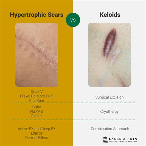 Best Treatments For All Types Of Scars Explained Laser Ny