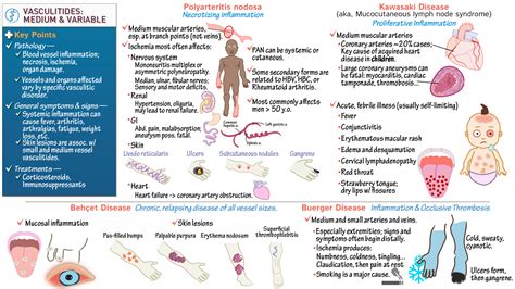 Nursing Rn Vasculitis Medium Variable Vessel Sizes Draw It To