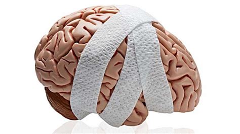 Daño cerebral motivo para solicitar compensacion