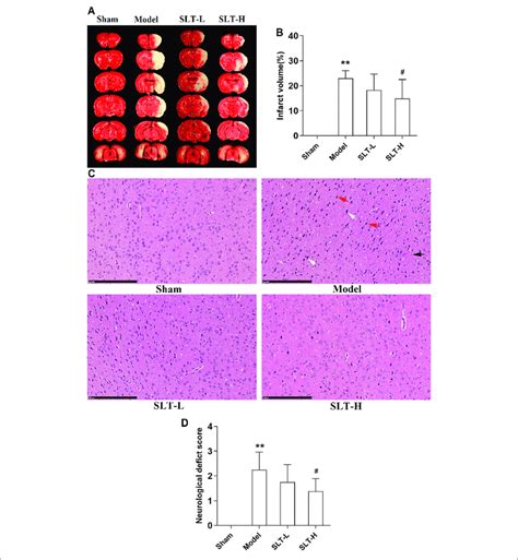 SLT Attenuated Cerebral Infarction And Neurological Deficit In Rats