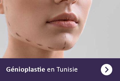 Chirurgie visage Tunisie Tarifs tout compris Qualité et sécurité