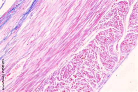 Tissue Of Small Intestine Duodenum And Vermiform Appendix Human Under