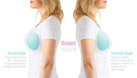 Breast Implant Types Northern Virginia Washington DC The Naderi Center