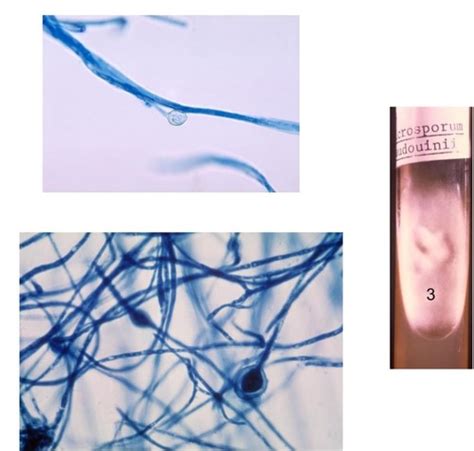 Mycology Molds Superficial Fungi Flashcards Quizlet