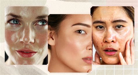 Tips Ampuh Merawat Kulit Berminyak Katalog Skincare