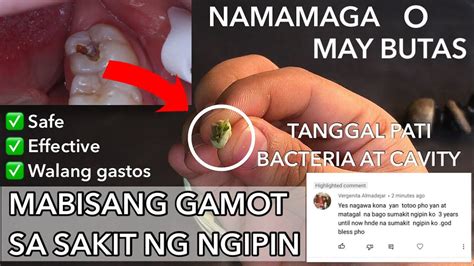 Effective Tips At Mabisang Gamot Sa Sakit Ng Ngipin Ito Na Ang Gamot