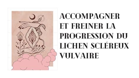 Accompagner et freiner la progression du lichen scléreux vulvaire YouTube