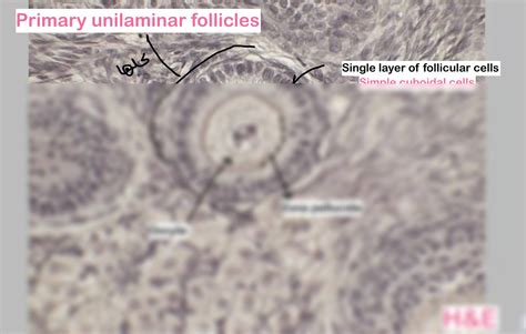 Solution Histology Female Reproductive System Part Studypool