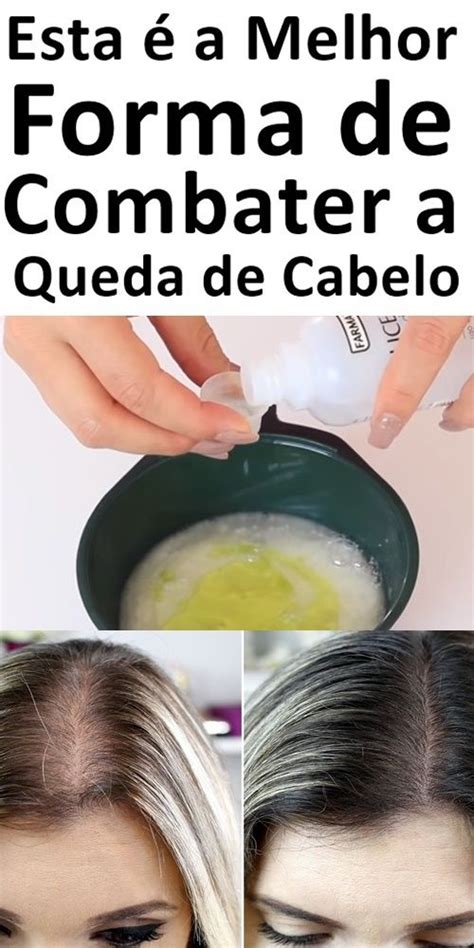 10 Remédios Caseiros Para Combater a Queda de Cabelo Queda de cabelo