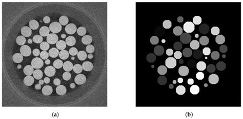 Tomography Free Full Text Sinogram Inpainting With Generative