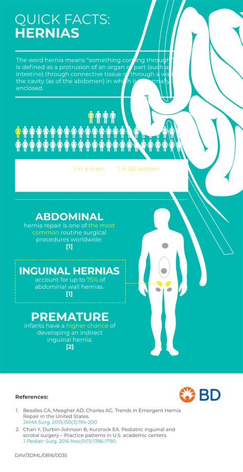 Pdf Quick Facts Hernias Sit Hernias The Word Hernia Means