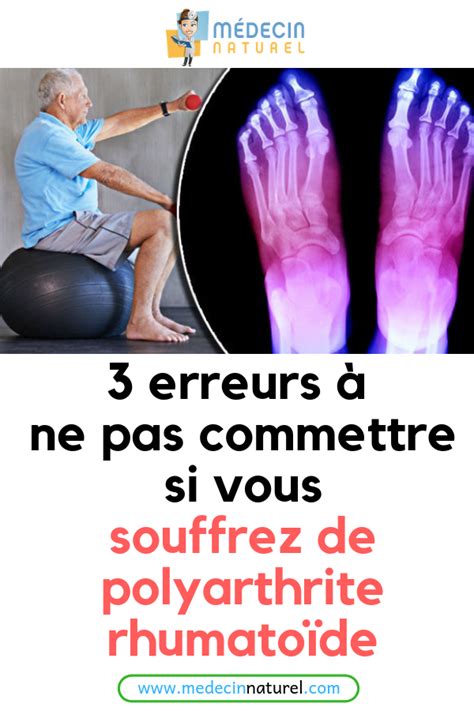 3 erreurs à ne pas commettre si vous souffrez de polyarthrite