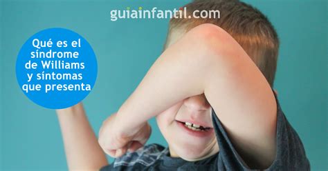 Síndrome de Williams en niños Síntomas tratamiento y diagnóstico