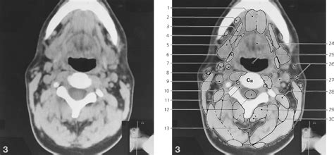 CT Series Radiology Key