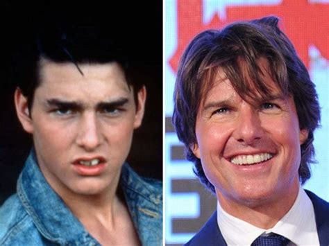 Total 36 Imagen Tom Cruise Before And After Teeth Fr Thptnganamst Edu Vn